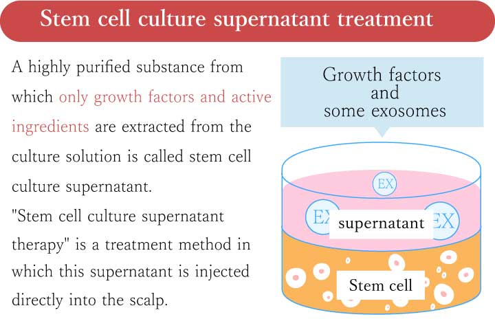 Stem cell culture supernatant treatment - 大阪AGA加藤クリニック
